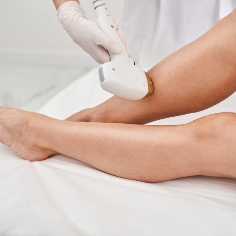 Aerolase Laser Hair Removal – Bella Derma